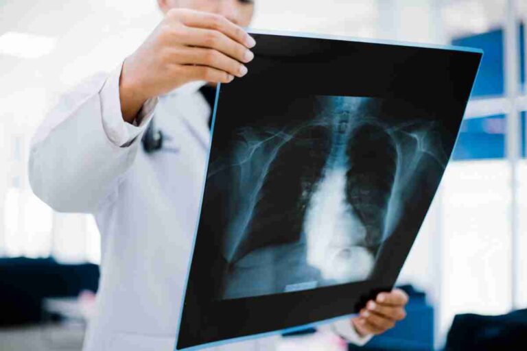 Radiografia al torace a Roma: quando effettuarla e come prenotarla ...